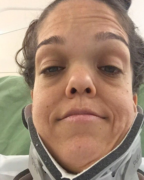 Former Little Women: LA Cast Member Traci Harrison Tsou Undergoes ...