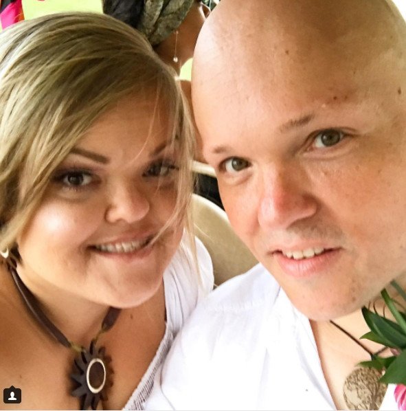 Little Women: LA Star Todd Gibel Weight Loss Surgery Success Story