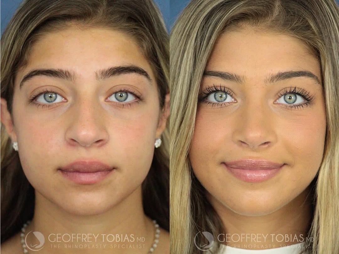 RHONJ's Gia Giudice Nose Job — Before and After Photos - Reality Tea