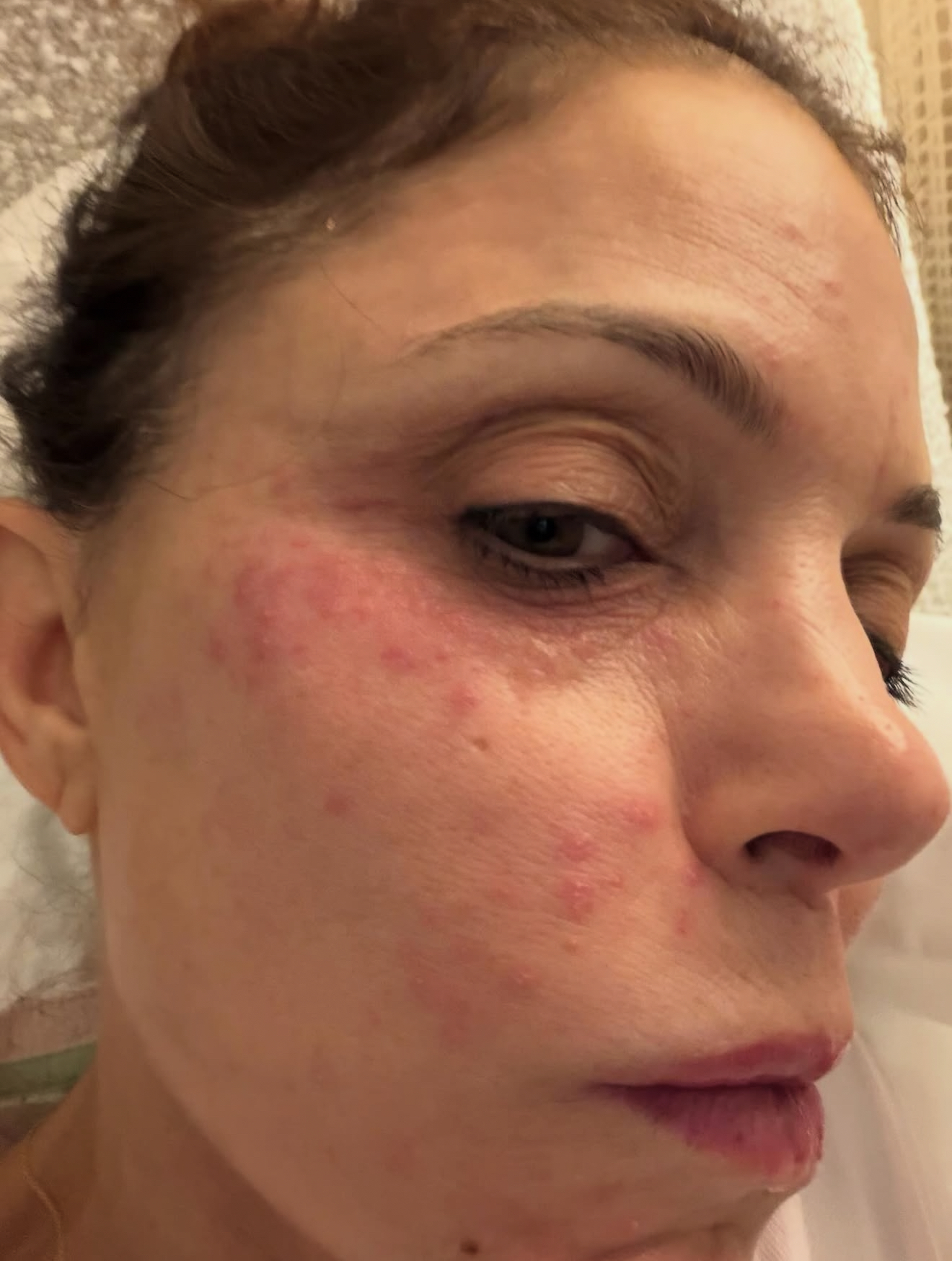 Bethenny Frankel Cuts Vacation Short After Health Issue - Reality Tea