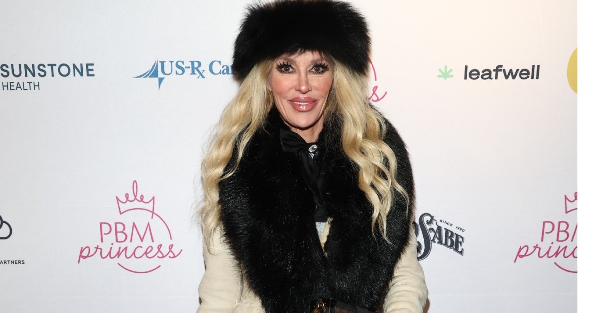 Brandi Glanville on ‘Sexually Transmitted’ Ringworm - Reality Tea